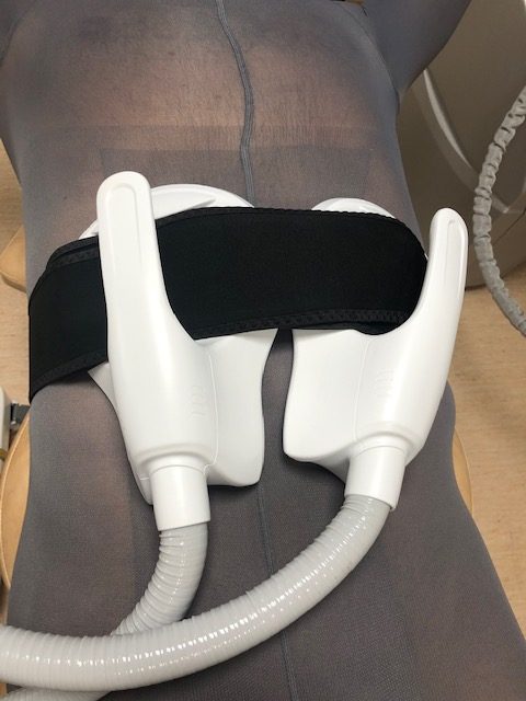 Rena Sculpt HIEMT (High-Intensity Electromagnetic Muscle Trainer)